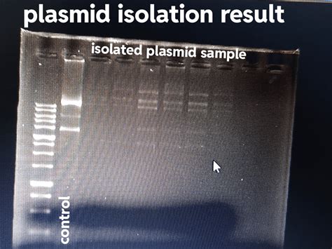 Strange Band Pattern Of Plasmid Dna R Labrats