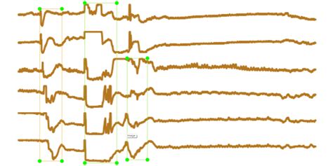 Questions About Training Self Generated Signal Images Ultralytics Yolov Discussion