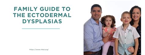 This Guide National Foundation For Ectodermal Dysplasias