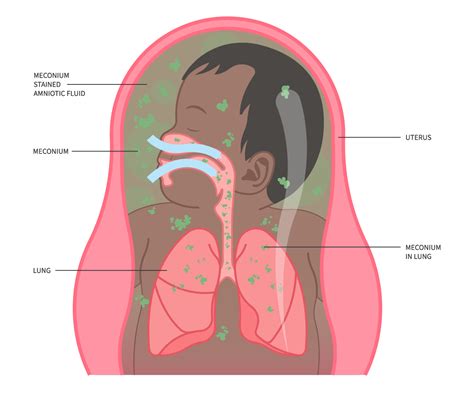 Fetal Development Tutorial Sophia Learning