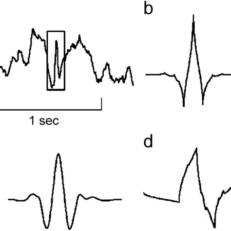 A The Ecg Artifact In The Eeg In The Frame B Coiflet 1 Wavelet Download Scientific