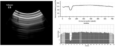 Left Reverberation Image Of The Rab4 8 D Transducer Notice The Loss Download Scientific
