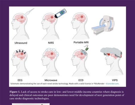 given the need for rapid portable stroke diagnostic technology our