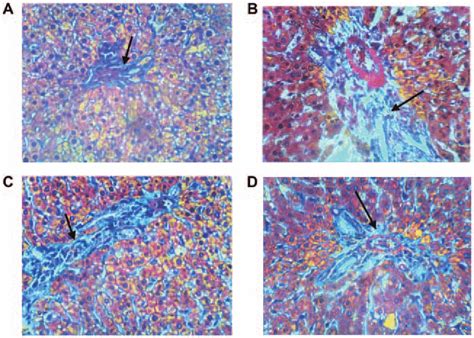 Histological Examination Of Liver Sections From The Four Treatment