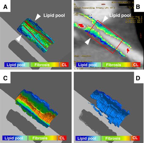 Representative Case Of Three Dimensional 3d Color Coded Maps