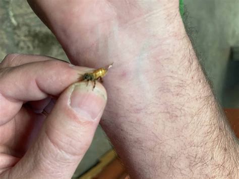 Apitherapy Bee Venom Therapy Bees Meyer Bees