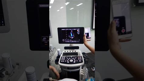 QBit5 Cardiac Image Introduction YouTube