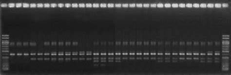 rapd profiles of different 10 lentil varieties using primer opa 20