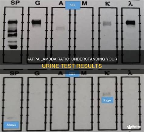 Kappa Lambda Ratio Understanding Your Urine Test Results Medshun
