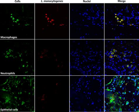 Immunofluorescence Colocalization Of L Monocytogenes And Host Cells Download Scientific