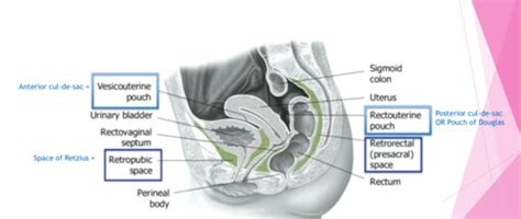 Exam 1 Pelvic Anatomy 3 Flashcards Quizlet