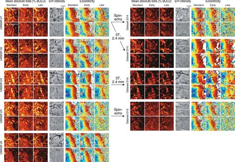 Decomposition Of Brain Activity Patterns Across Datasets And Download Scientific Diagram