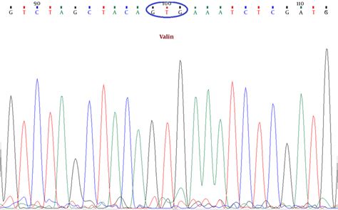 An Electropherogram Related To A Patient With Wild Type Braf The