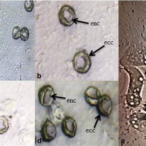 Acanthamoeba Species Isolated From Philippine Freshwater Systems Epidemiological And Molecular