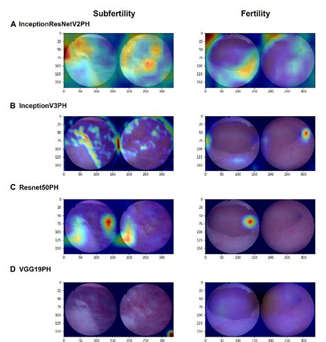 Figure 1 From Artificial Intelligence Driven Prognostic System For Conception Prediction And