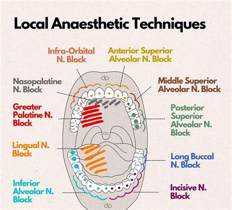 Local Anesthesia Techniques Medizzy