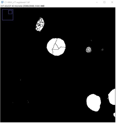 This Automatically Generated Binary Mask Of A Cell Nucleus Looks Like