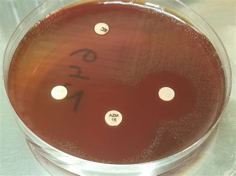 Streptococcus Sanguinis Introduction Morphology Pathogeni