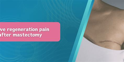 Is It Normal To Have Pain Months After A Lumpectomy Dr Garvit Chitkara