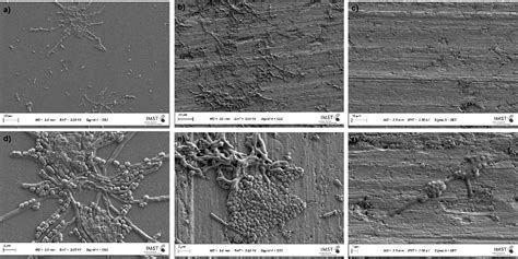 Figure 9 From A Bacteria And Cell Repellent Zwitterionic Polymer Coating On Titanium Base