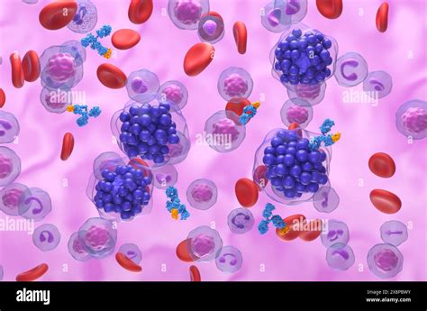 Diffuse Large B Cell Lymphoma DLBCL Isometric View D Illustration Stock Photo Alamy