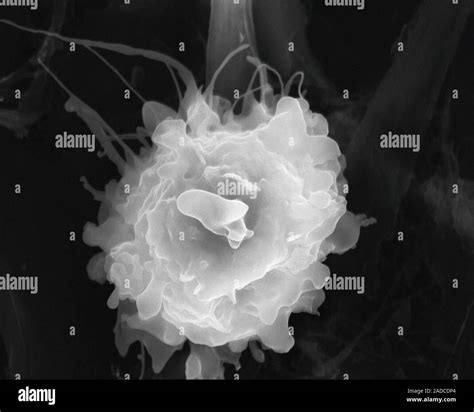 Apoptotic Muscle Cell Early Stages Of Cell Death Apoptosis Scanning