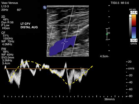 Vascular Laboratory Venous Duplex Scanning Clinical Tree