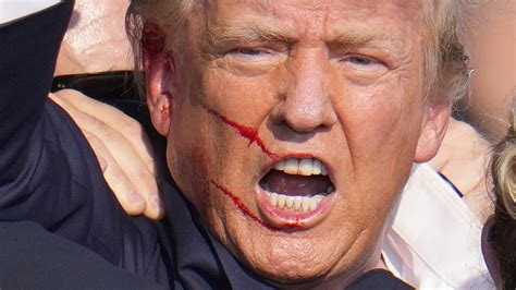 Fbi Confirms Donald Trump Was Struck By Bullet During July 13