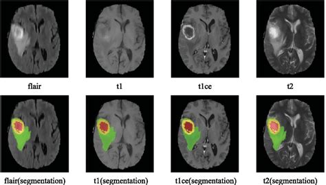 input images with four mri modalities and the corresponding