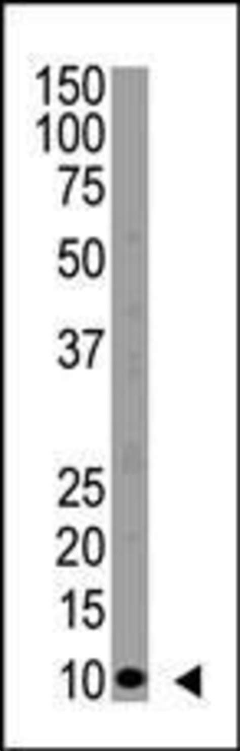 Ubiquitin Polyclonal Antibody Invitrogen 400 μl Unconjugated