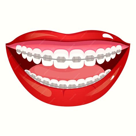 Girl Red Lips Smile With Teeth With Orthodontic Braces Premium Vector