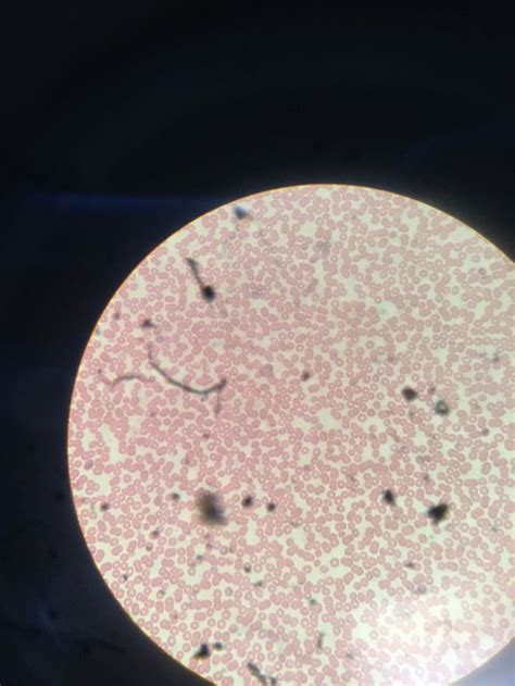 Eritrocitos En Microscopio