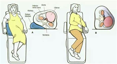 Posición De La Mujer Embarazada En El Sillón Dental