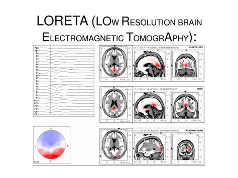 Ppt Event Related Potentials Erp Powerpoint Presentation Free Download Id 910767