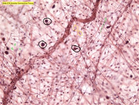 Connective Tissue Practice 3 Flashcards Quizlet