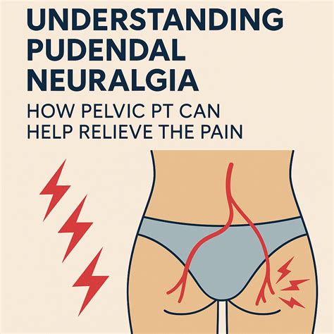 Understanding Pudendal Neuralgia Hidden Strength Pt Pelvic Health
