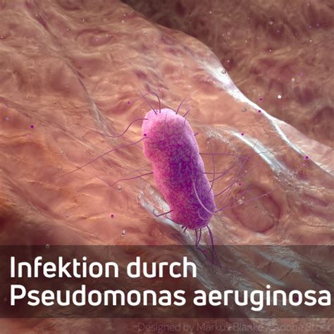 Pseudomonas Im Urin Ursachen Diagnostik Behandlung