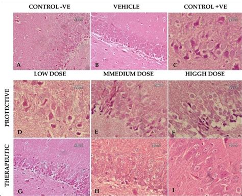 A Photomicrograph Of Hippocampus Sections From Brain Tissues Of Male Download Scientific