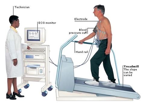 Stress Treadmill Test A Whole Heart Function Analysis