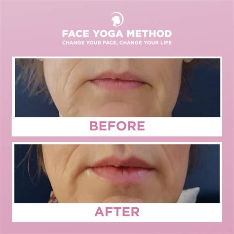 150 Before And After Ideas To Save Today Face Yoga Method Face Yoga