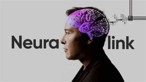 Se Implantó El Chip Neuralink En El Cerebro Y Pudo Hacer Algo Sorprendente