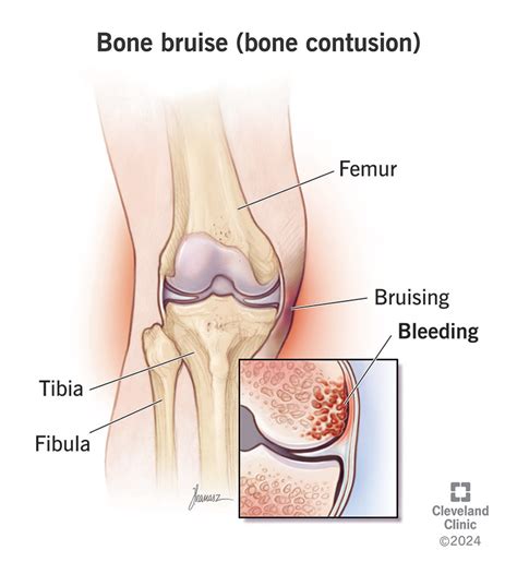 Controverse Định Nghĩa và Cách Sử Dụng Trong Tiếng Việt