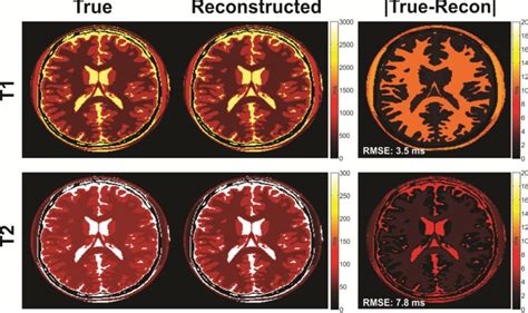 Figure 4 From Deep Learning For Rapid Sparse Mr Fingerprinting Reconstruction Semantic Scholar