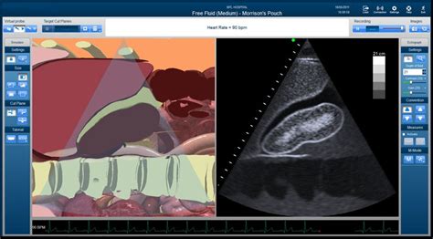 Ultrasound Medical Simulation Center