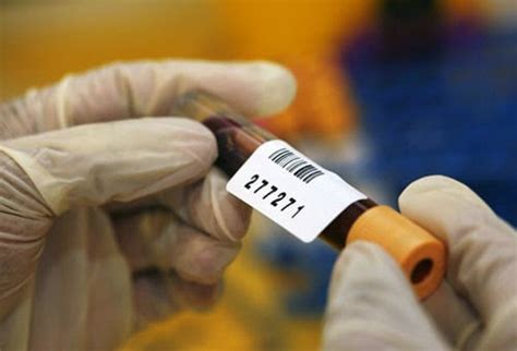 Medical Laboratory And Biomedical Science Swedish Model For Psa