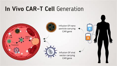 In Vivo Car T Breakthrough Cancer Treatment Revolution Cancerrounds