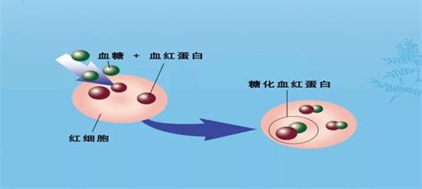 盘点检验项目里的 双胞胎”疾病相关检验视界检验视界网