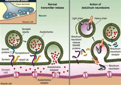 Toxina De Clostridium Botulinum Botulinum Toxin Clostridium Botulinum