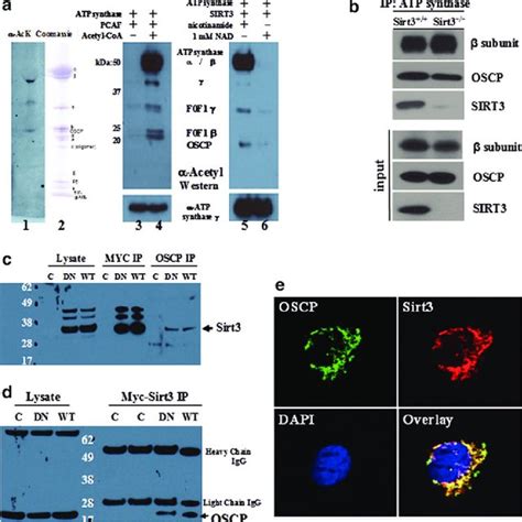 The Adenosine Diphosphate Atp Synthase Complex Contains Multiple Download Scientific Diagram