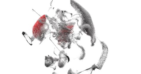 La Ia Ayuda A Mapear La Biología De Las Lesiones Medulares Con Un Detalle Sin Precedentes Infobae